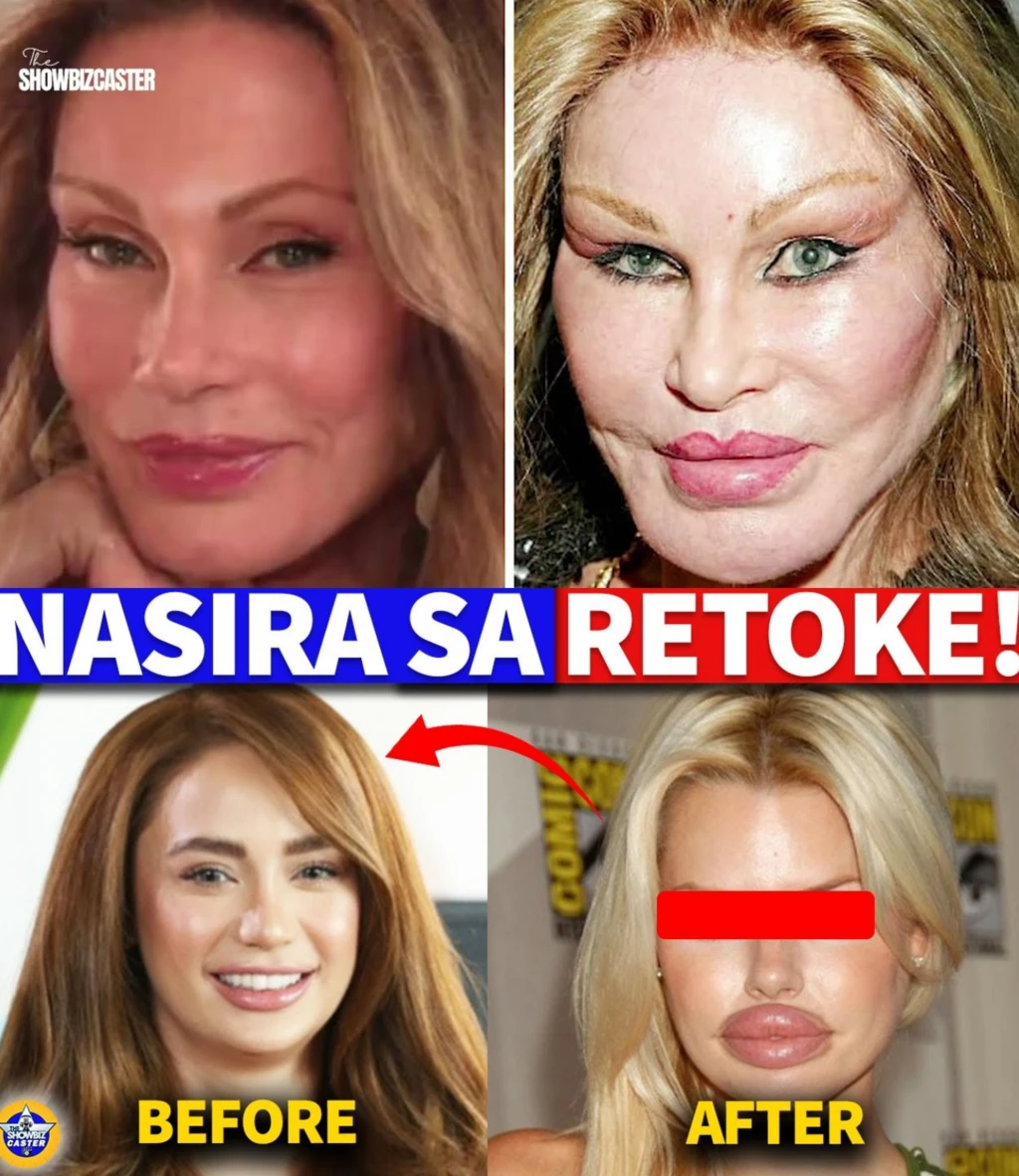 ANG MAPAIT NA PRESYO NG PERPEKSYON: 5 Kilalang Artista, Bakit Tila ...